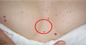 Should red spots on various part of your body worry you and what to do ...